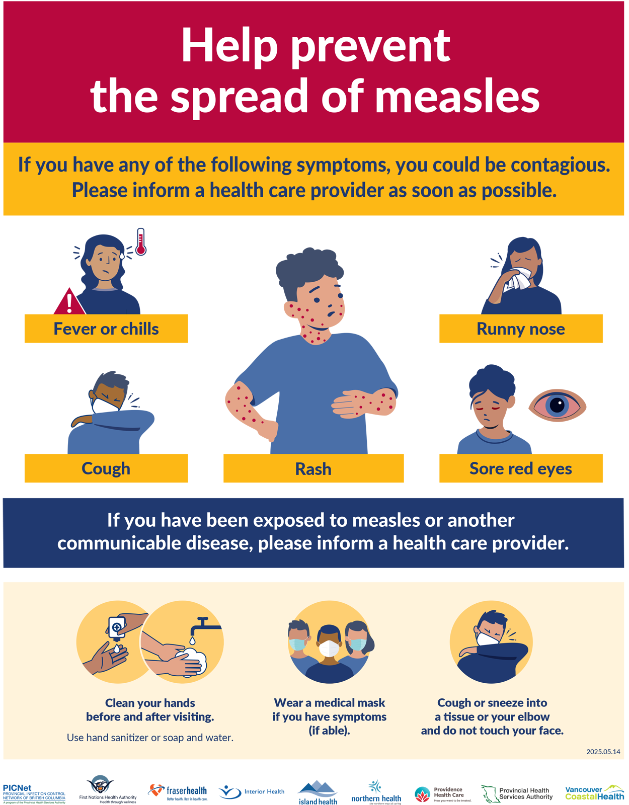 Measles